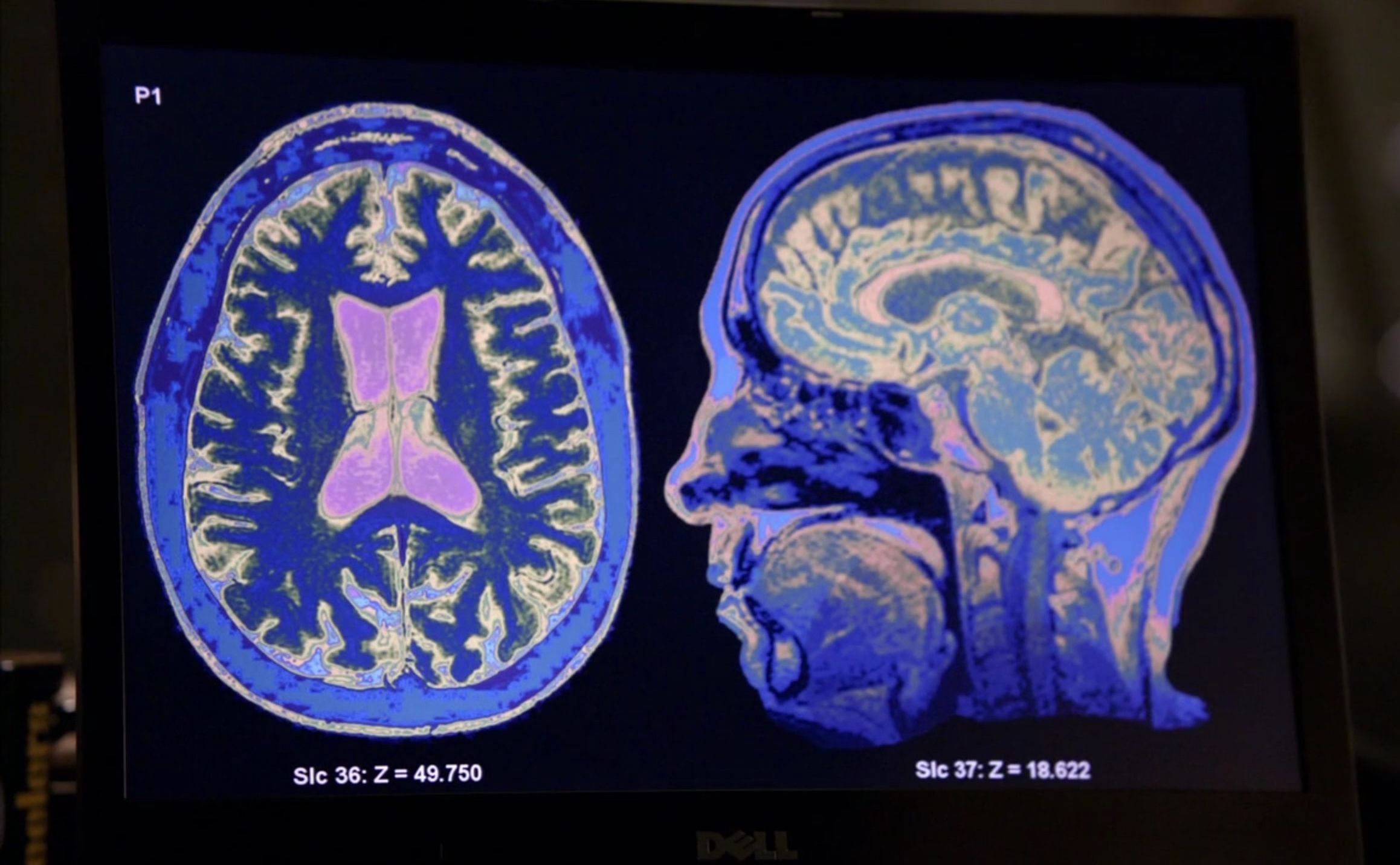 Bones: 20 Things About Booth And Brennan’s Relationship That Make No Sense