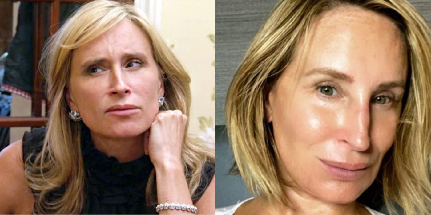 RHONY: 9 Plastic Surgery Procedures The Cast Has Admitted To