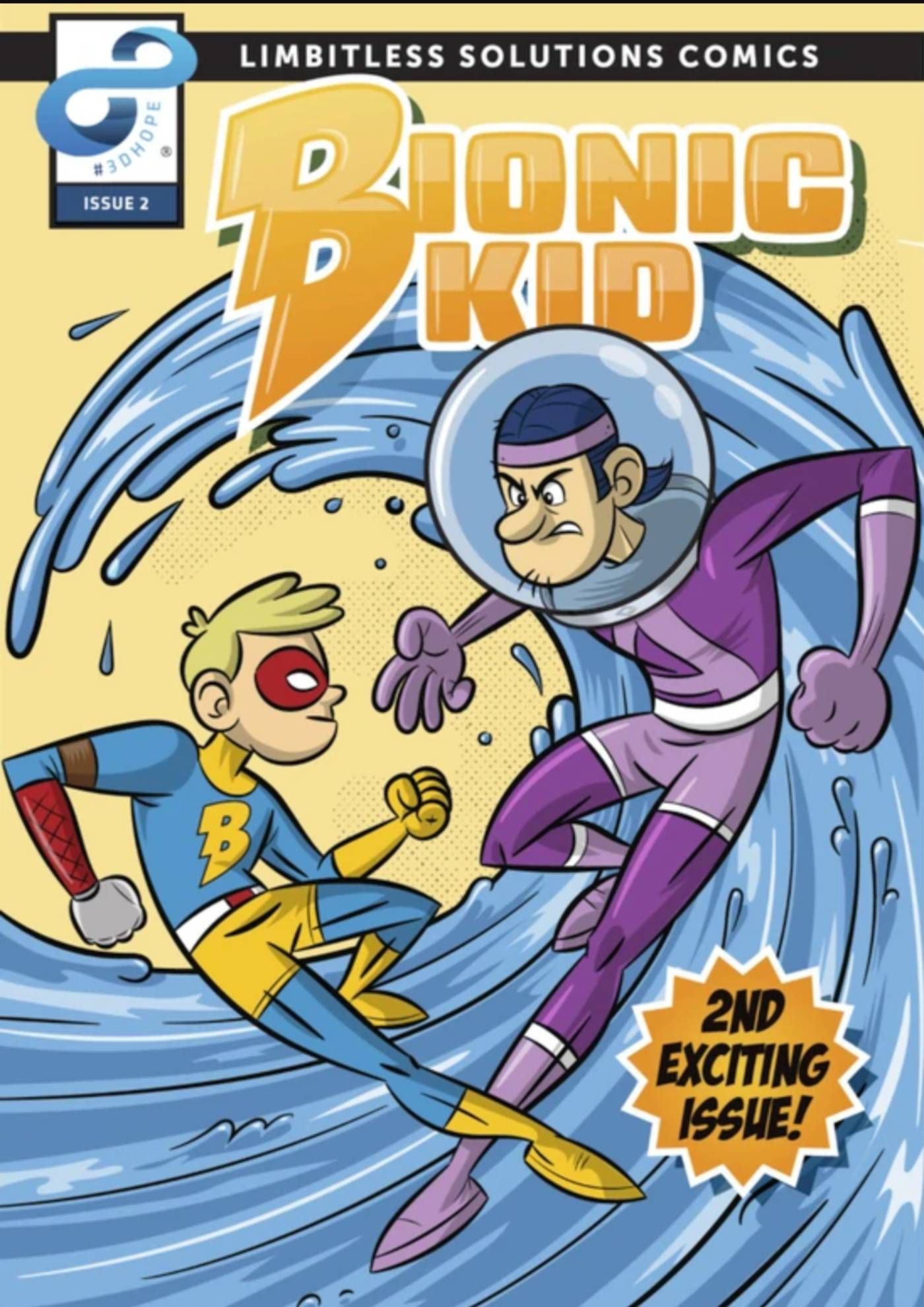 Teen Brothers Create Comics To Pay For Prosthetic Arm