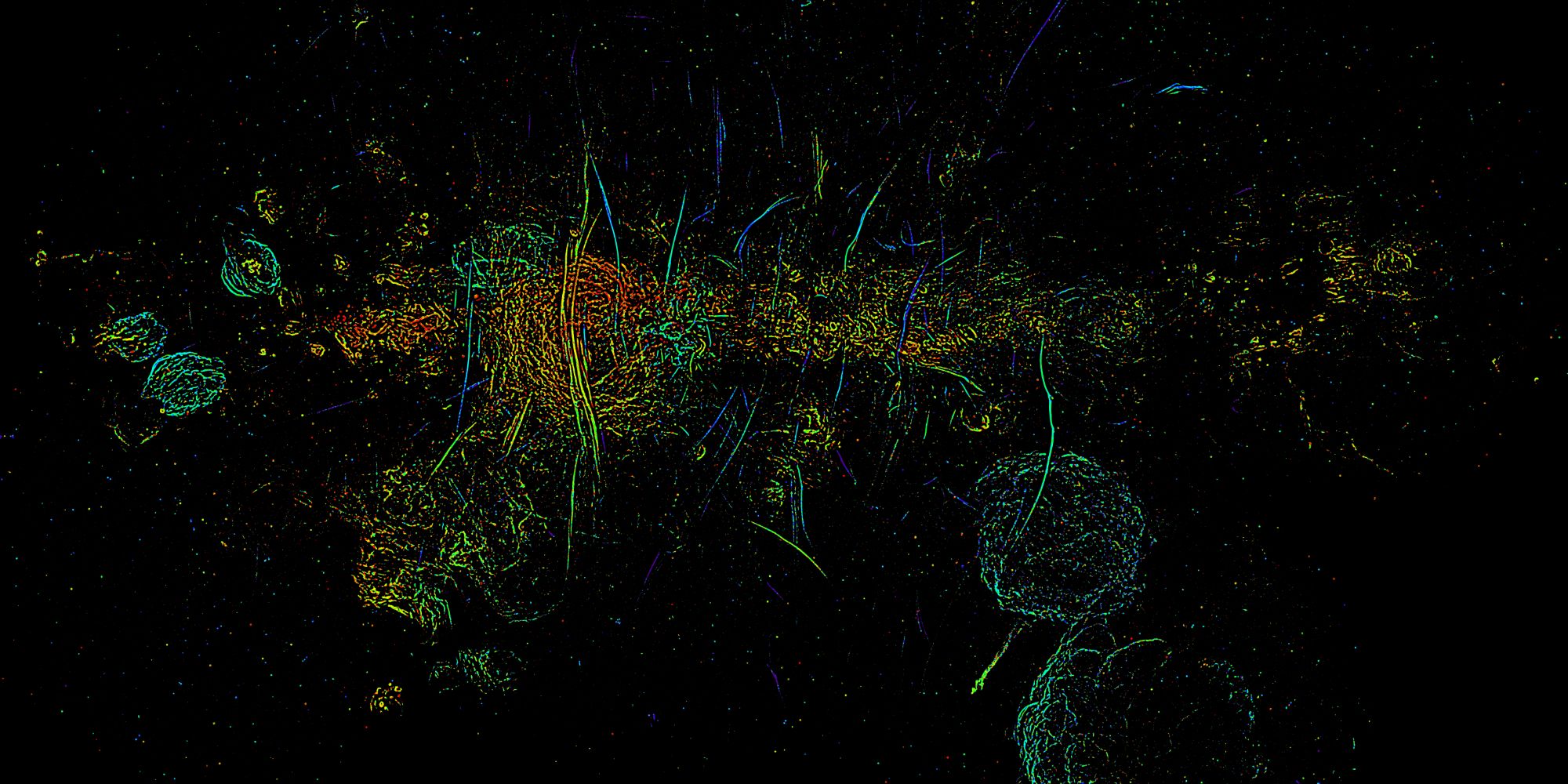 What Are These Bizarre Strands Doing In The Milky Way?