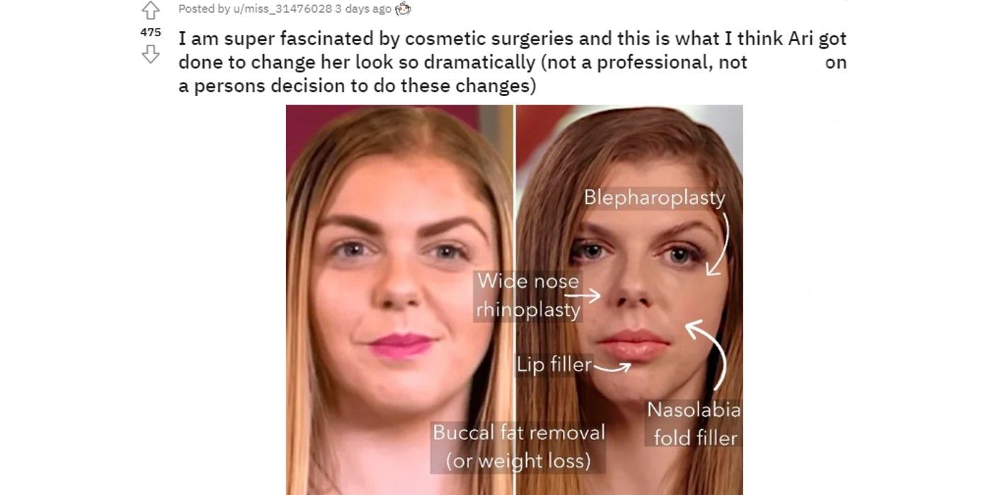 90 Day Fiancé: All Cosmetic Procedures Fans Think Ariela Had Done