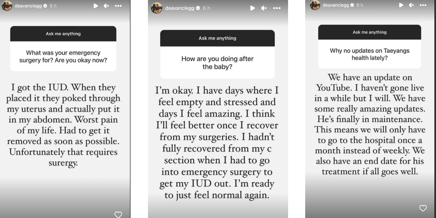 90 Day Fiancé’s Deavan Reveals Why She Underwent Emergency Surgery