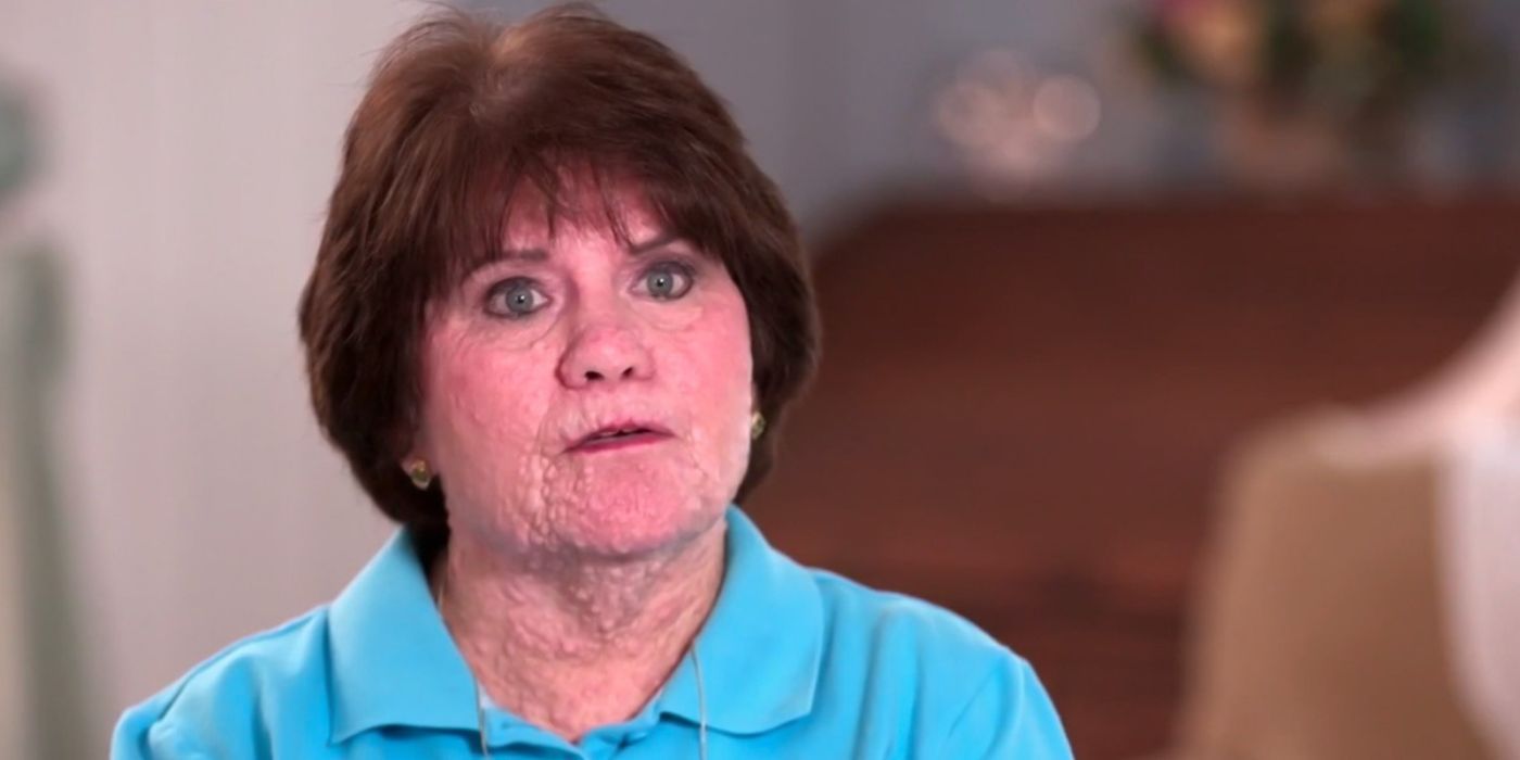 10 Most Extreme Dr Pimple Popper Episodes Ranked By Intensity