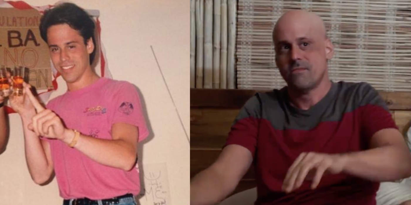 What Skin Condition Does 90 Day Fiancé Star Gino Palazzolo Have?