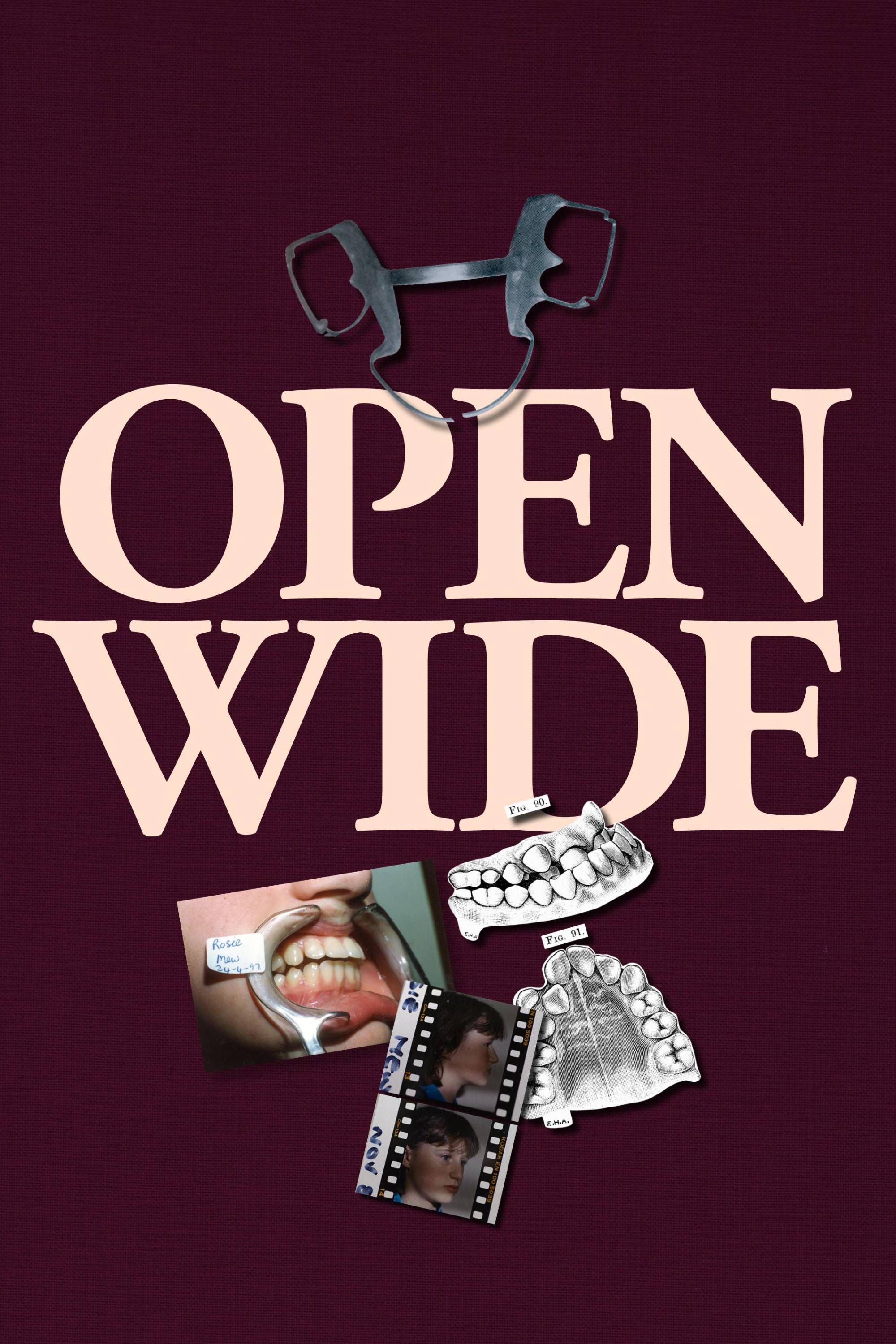 Open Wide | ScreenRant
