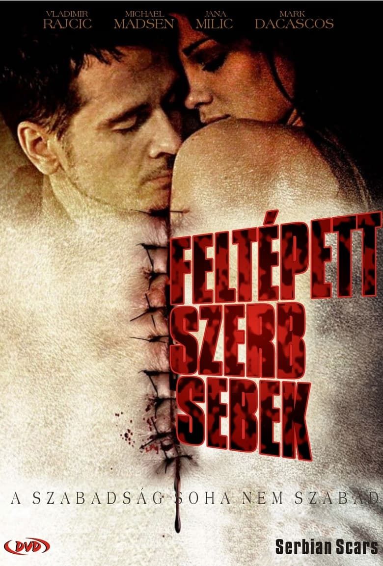 Serbian Scars Summary, Latest News, Trailer, Cast, Where to Watch and More