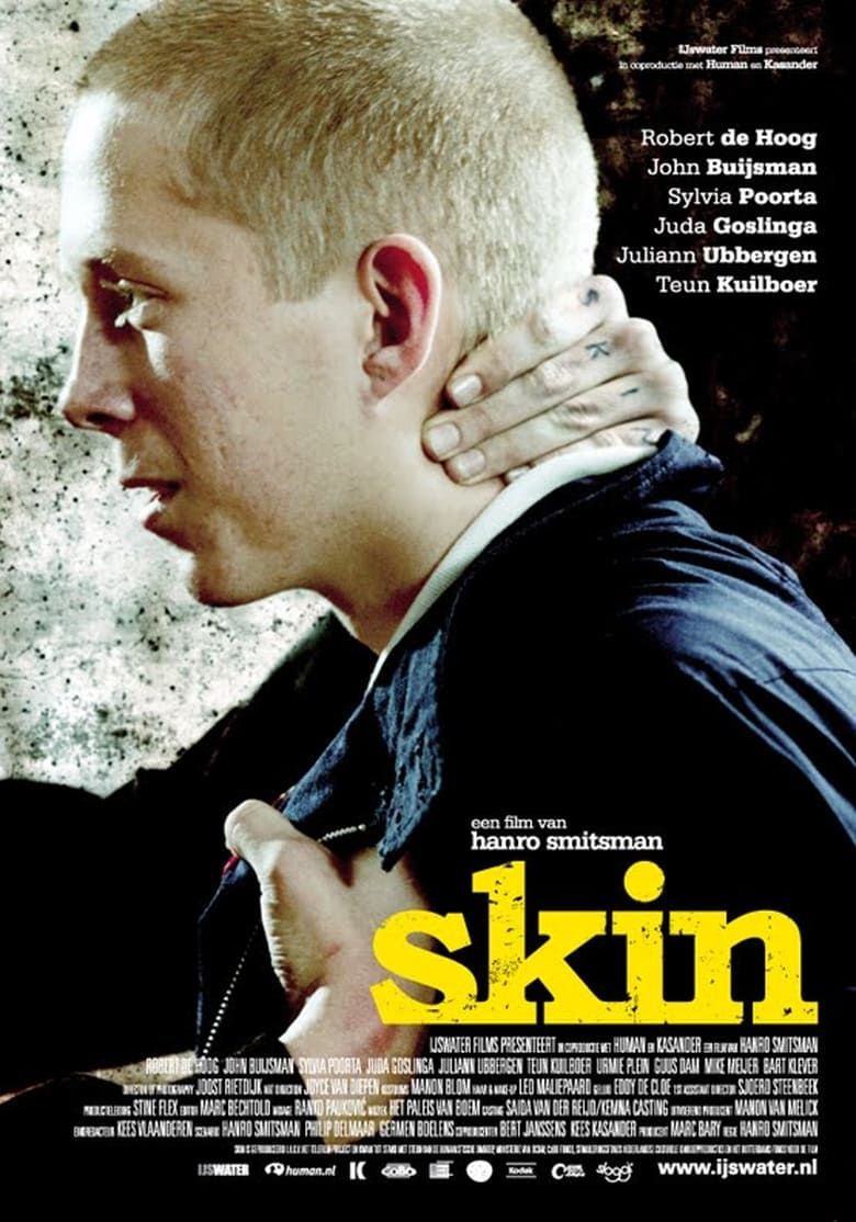 Skin Summary, Latest News, Trailer, Cast, Where to Watch and More