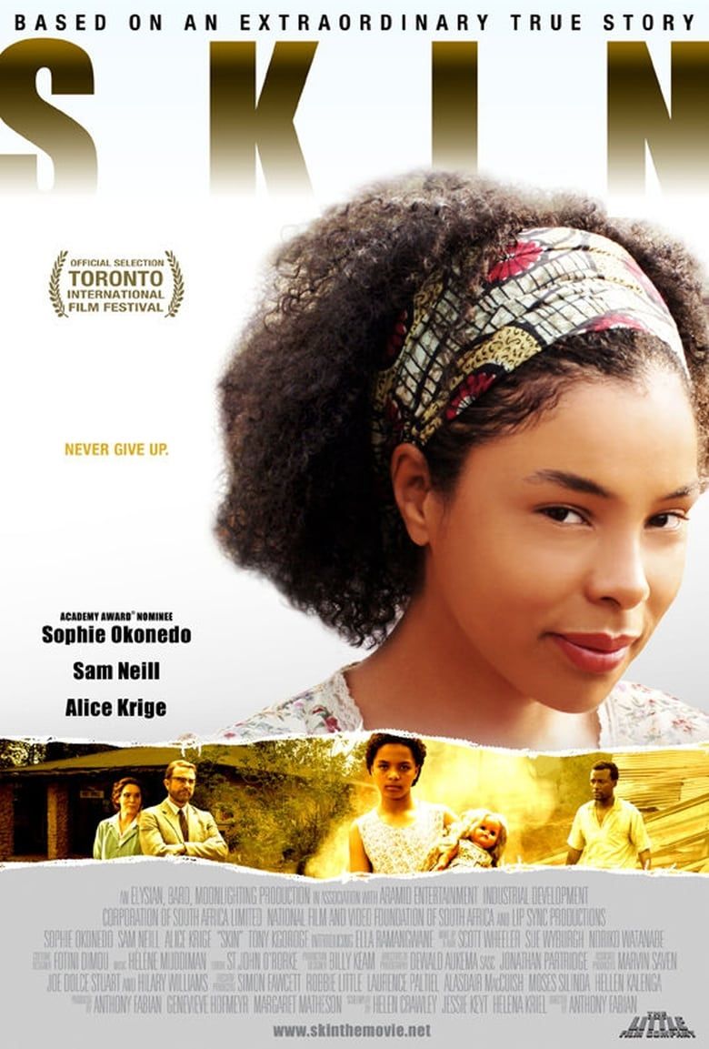 Skin Summary, Latest News, Trailer, Cast, Where to Watch and More